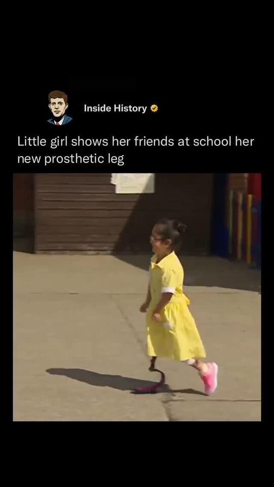 A seven-year-old girl with an amputated leg has been filmed showing new ...