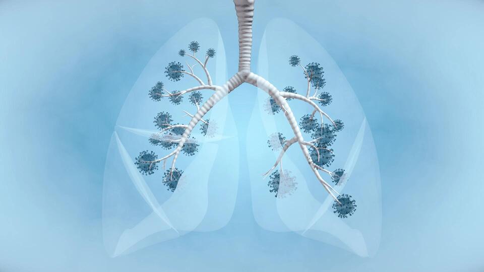 Combining Drugs, Radiation Is ‘Practice-Changing’ for Some Lung Cancer ...