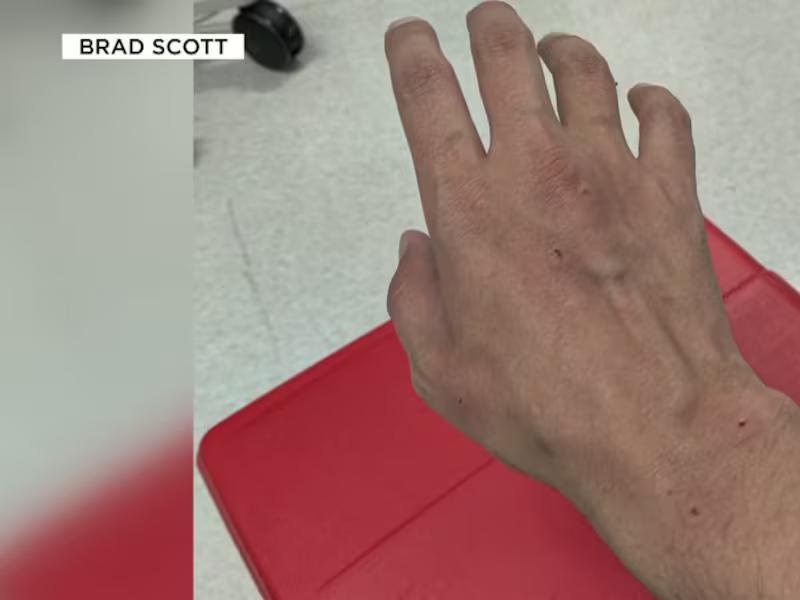 Bees sting father over 100 times as he protects 11-year-old daughter ...