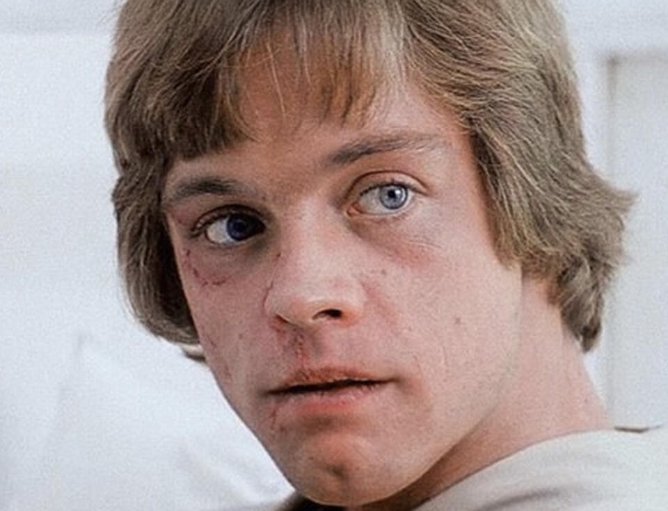 Famous Actors With Scars, And How They Got Them - NewsBreak