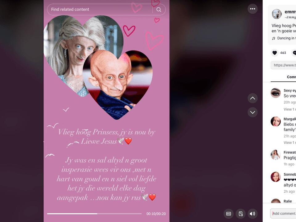 TikTok star Beandri Booysen dies at 19 after battle with rare disorder ...