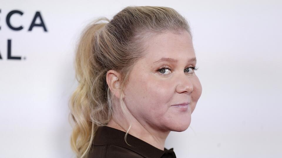 Before & After Pics Of Amy Schumer Make Her 'Ozempic Face' Obvious ...