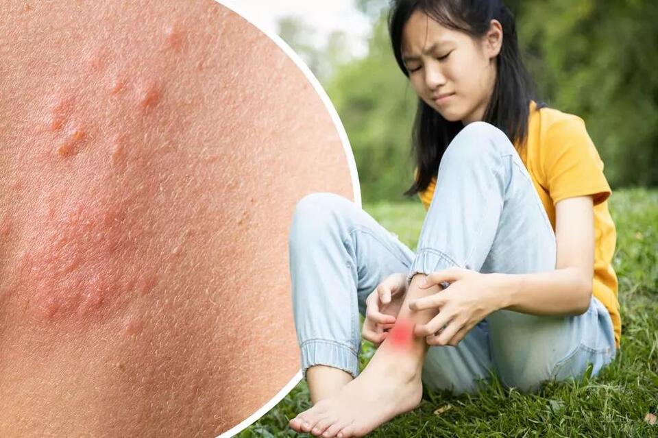 The Innocent Weed in Your Yard That Could Give you Horrifying Blisters ...
