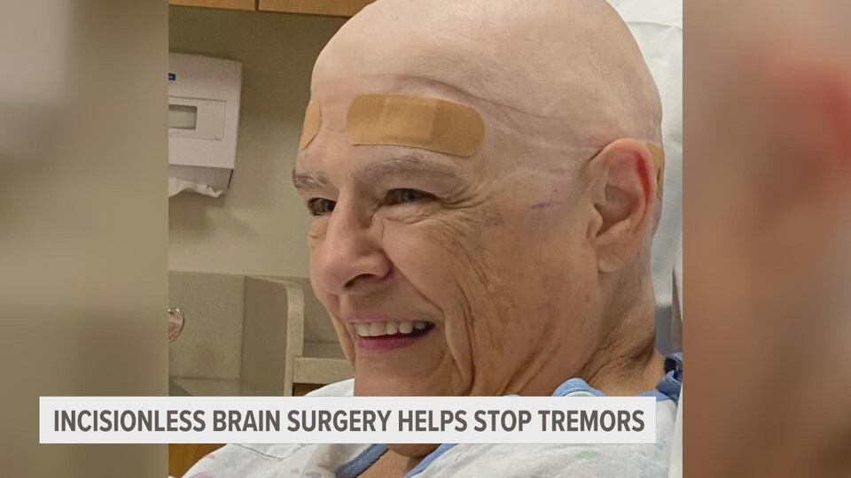 West Michigan hospital performs new type of brain surgery without an ...