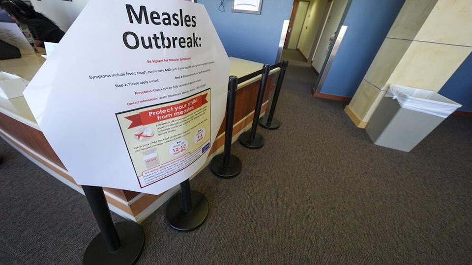 How measles spreads: What you need to know about this highly contagious ...