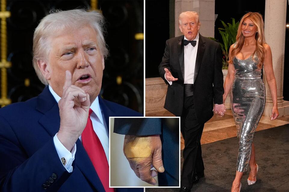 Trump doubles down, insists he is in ‘perfect health’ and he ‘aced ...