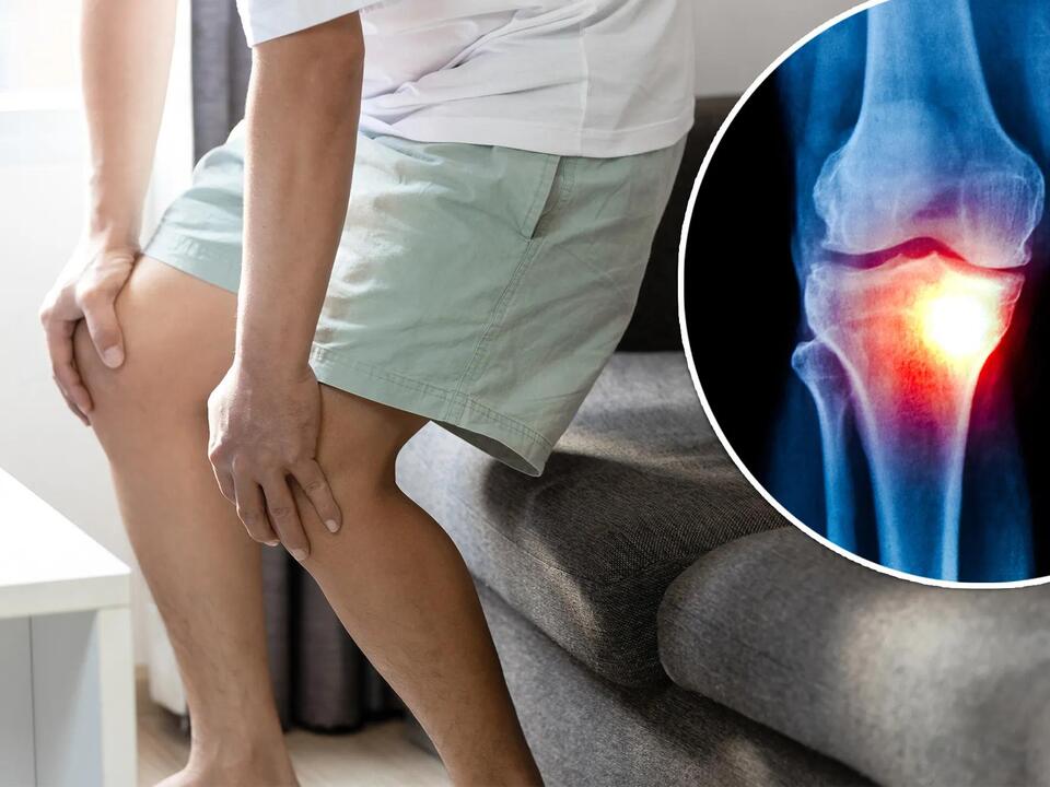 Pops and cracks in knees — why it happens and when to seek treatment