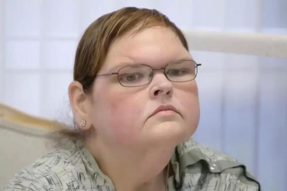 Why ‘1000-Lb. Sisters’ Star Tammy Slaton Can’t Get Skin Removal Surgery ...