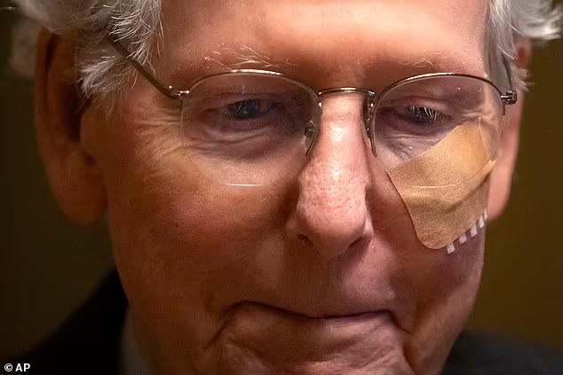 Senator Mitch McConnell, 82, falls down Senate stairs in latest health ...