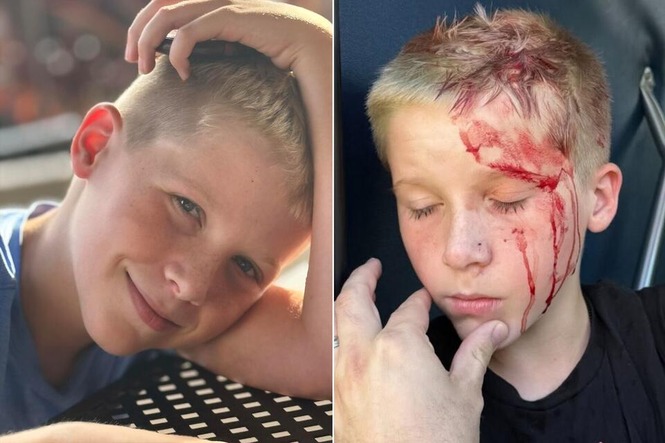 St. Johns County school bus backpack attack leaves student bloodied and ...