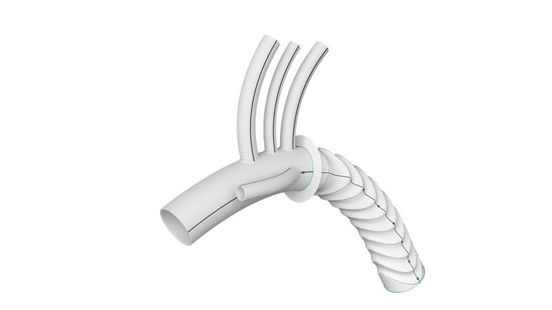 Terumo Aortic announces ‘significant policy milestone’ with CMS ...