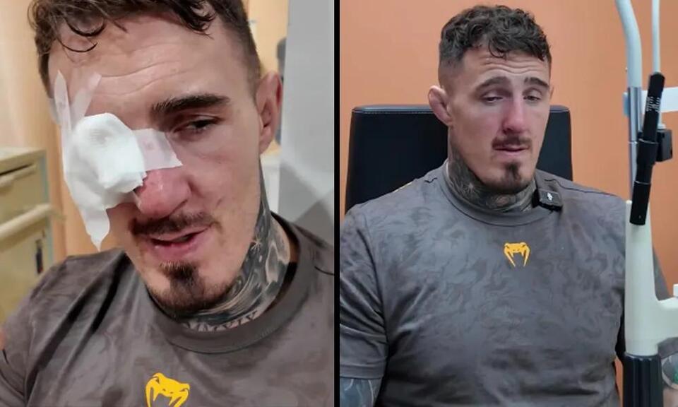 Tom Aspinall reacts to UFC 321 no contest, updates condition of eye ...