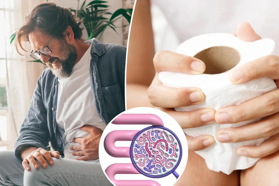Is it really IBS? This lesser-known stomach issue is often misdiagnosed ...