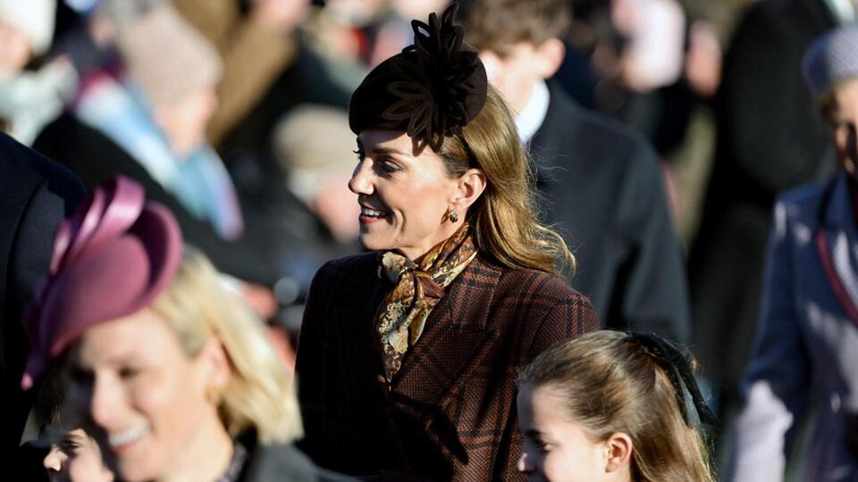 Apparent Scar on Kate Middleton’s Face Sparks New Wave of Conspiracy ...