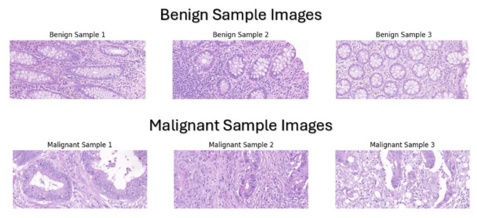 Optimized deep learning architectures for the classification of ...