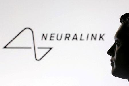 Neuralink's speech restoration device gets FDA's 'breakthrough' tag ...