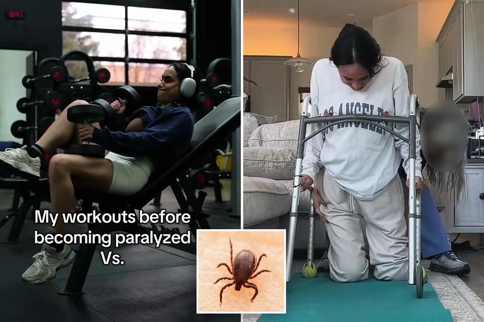 Fitness influencer, 31, left paralyzed from tick bite: ‘My body ...