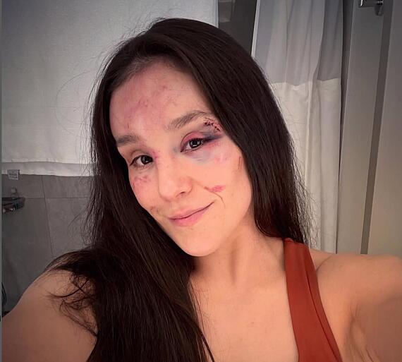 Alexa Grasso on UFC 315 Defeat: 'You Lose a Battle But Not the War ...