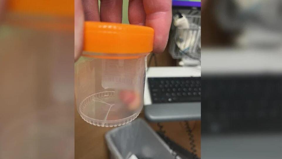 Officer 'will lose finger' after Minnesota rioter allegedly bites it ...