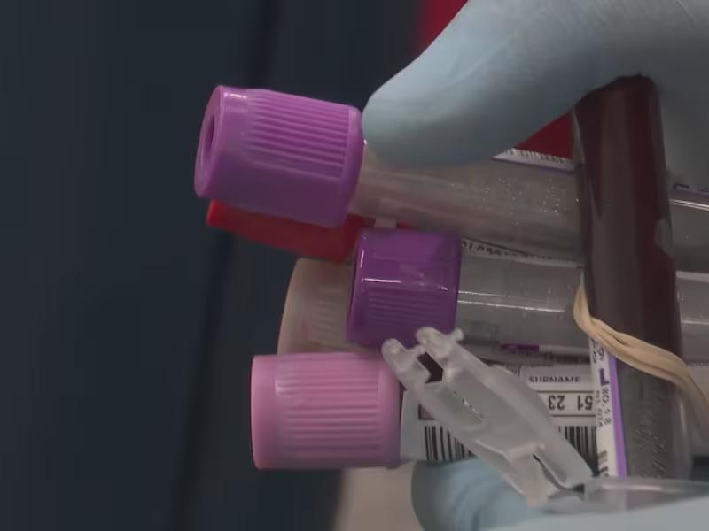 Blood donations crucial for those battling sickle cell disease