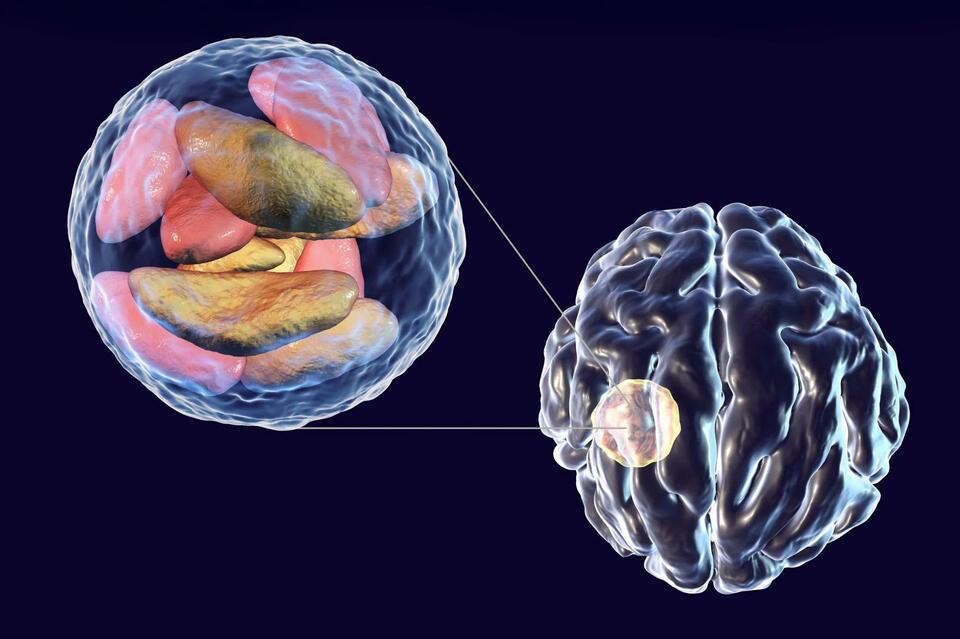 This Common Brain Parasite Can Infect the Immune Cells Meant To Kill It ...