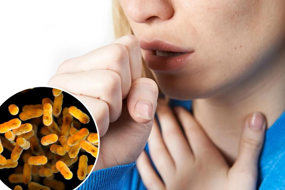 Whooping cough cases are twice as high as last year: CDC - NewsBreak