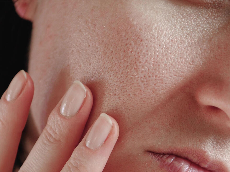 6 Unexpected Skincare Ingredients That Are Actually Making Dry, Wrinkly ...