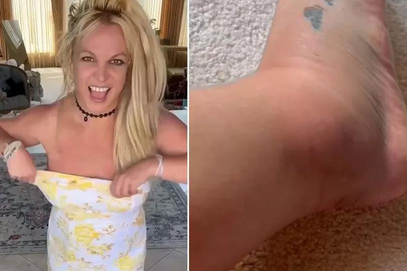 Britney Spears shows off swollen ankle from Chateau Marmont hotel ...
