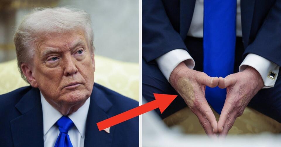 Ummm... Here's What Trump Looks Like Now, Since He's About To Get His ...