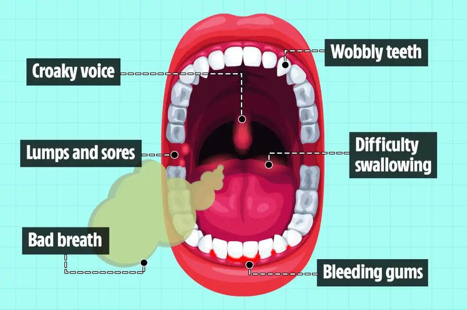 From ulcers to your gums – what your mouth says about your health and ...