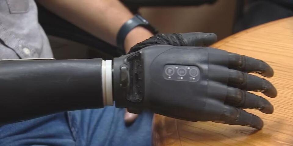 Yuma man loses arm in work accident, hopes to inspire others about ...