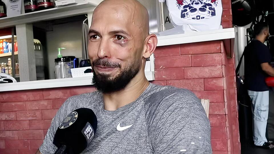 Andrew Tate Explains Black Eye Injury Ahead of Boxing Bout, & Talks ...