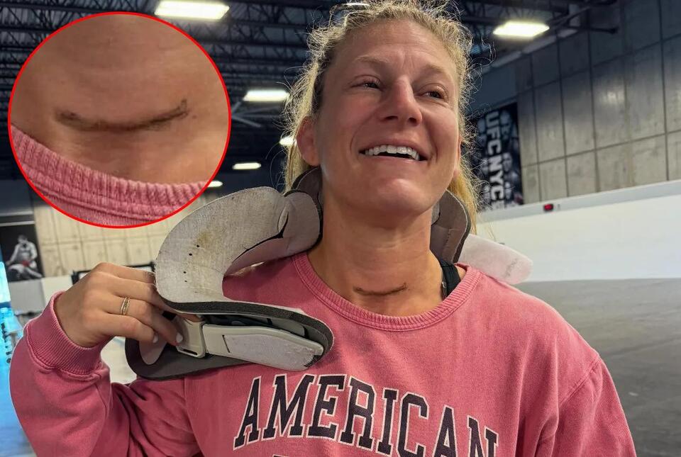 Pic: Kayla Harrison neck surgery leaves UFC champ with giant Franken ...