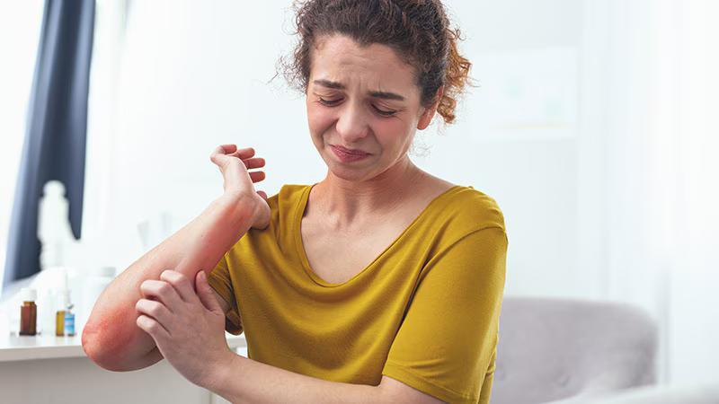 Fever Induced by Cotrimoxazole After Urinary Tract Infection Treatment ...