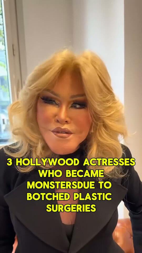3 Hollywood actresses who became monstersdue to botched plastic ...