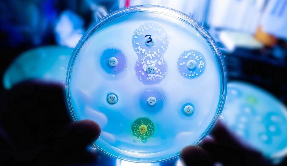 New “superbugs” discovered in hospitals devour medical plastics ...