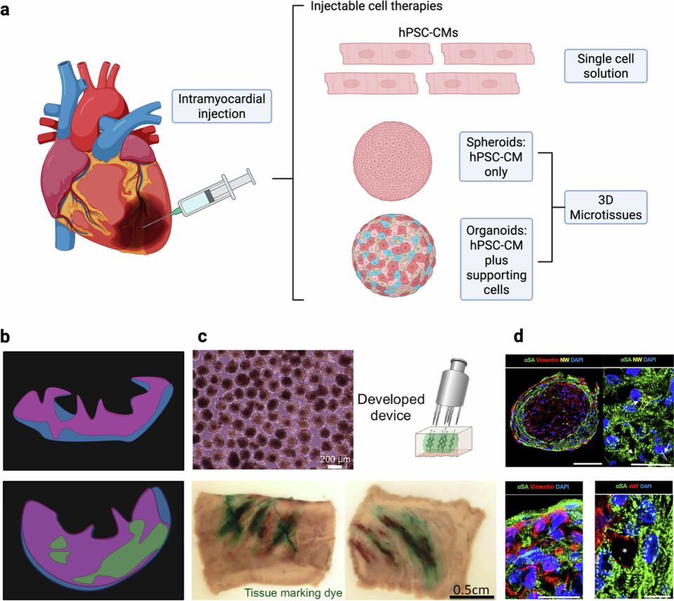 Progress and challenges in transplantation of human pluripotent stem ...