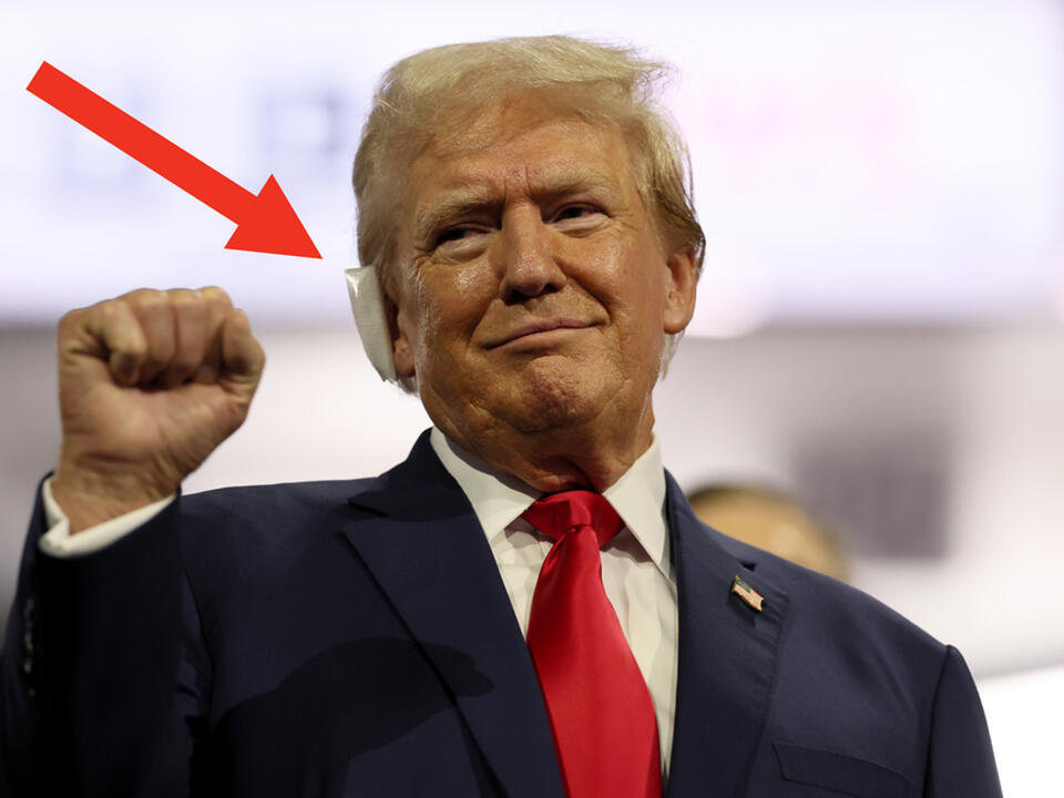 Here's What Donald Trump's Ear Bandage Looks Like Following The Rally ...