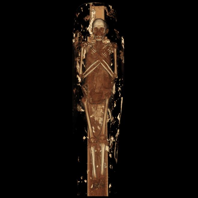 2,000-Year-Old Mummies Show Ancient Egyptians Had Back and Hip Pain ...