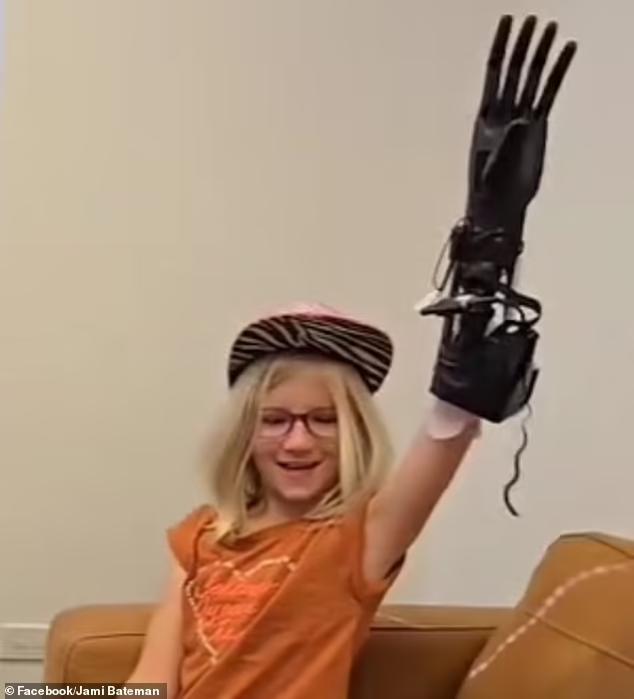 Family of nine-year-old girl born without her left arm are told new ...