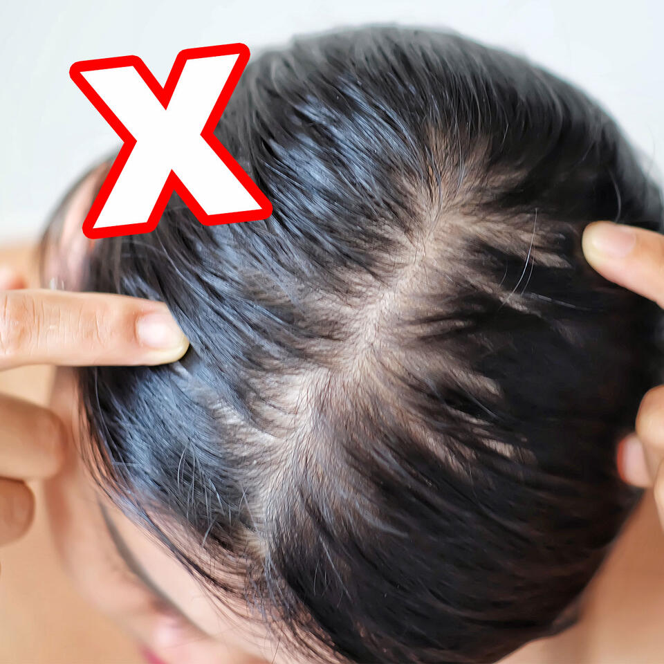 The 15 Worst Haircuts To Avoid For Thinning Hair Because They ...