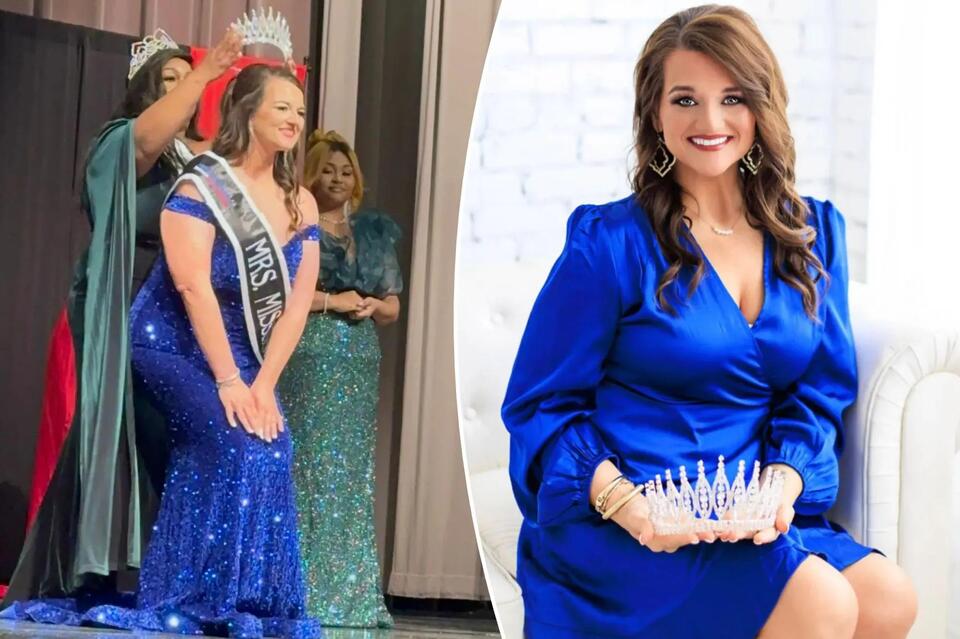 I was diagnosed with Stage 3 colon cancer at 33 — this was the symptom ...