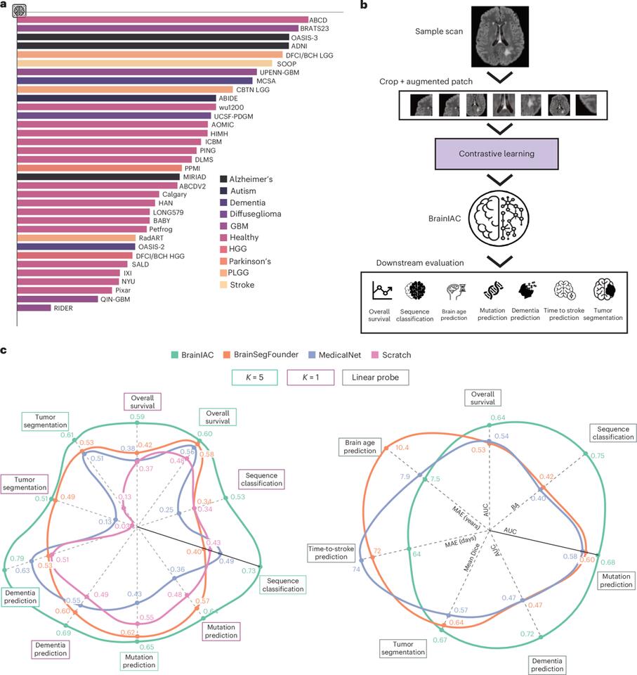 A generalizable foundation model for analysis of human brain MRI ...