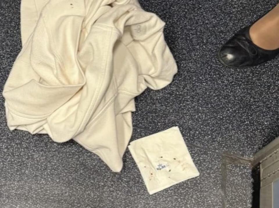 Family suing Delta, KLM airlines after flight ‘infested’ with bedbugs ...