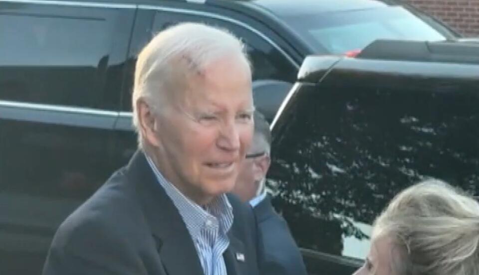 Joe Biden Spotted With Giant Gash on His Head After Skin Cancer Surgery ...