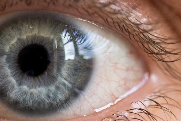 Can a Supplement Really Help You Control Those Pesky Eye Floaters ...