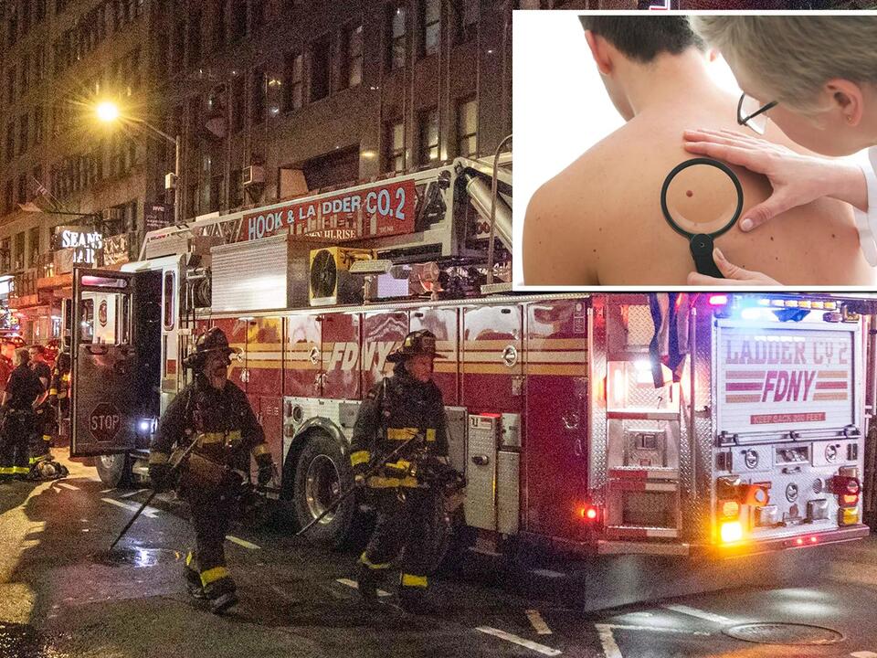 FDNY teams up with experts to offer free skin cancer screenings for ...