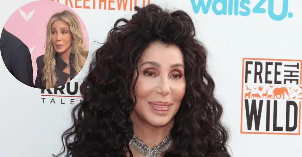 Fans Accuse Cher Of Too Much Plastic Surgery After Her VS Show ...