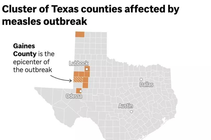 Map shows terrifying spread of measles as outbreak surges past 300 ...