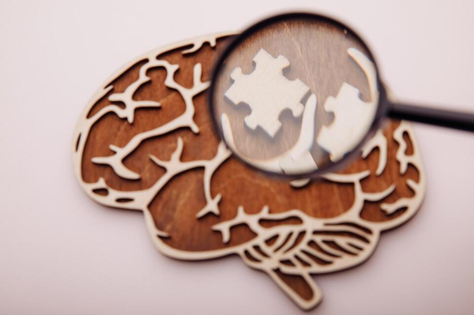 Scientists Map Aging Brain in Unprecedented Detail, Revealing Clues to ...